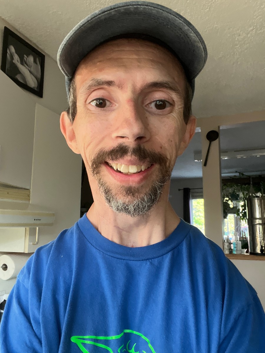 Hajdu-Cheney Syndrome – TC 'ventures